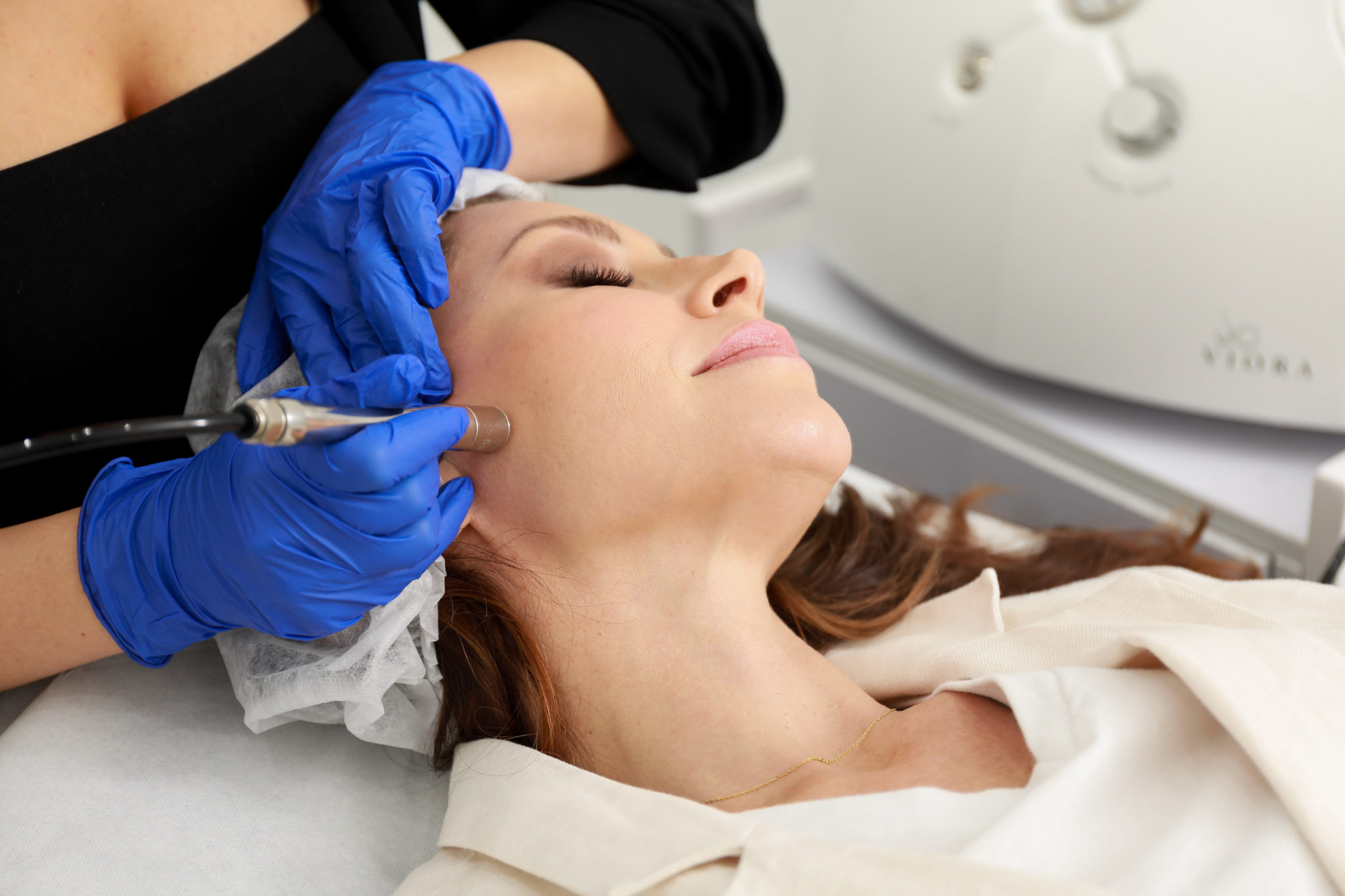 Micro Needling for Glowing, Youthful Skin | The Cosmetic Lounge