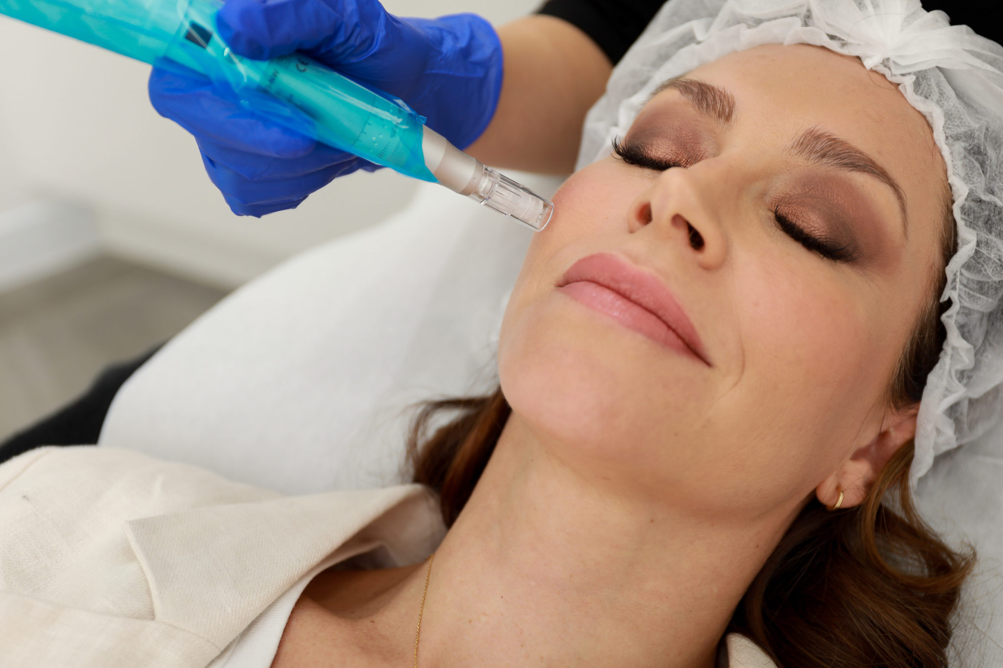 Collagen Stimulator Injection In Australia | The Cosmetic Lounge