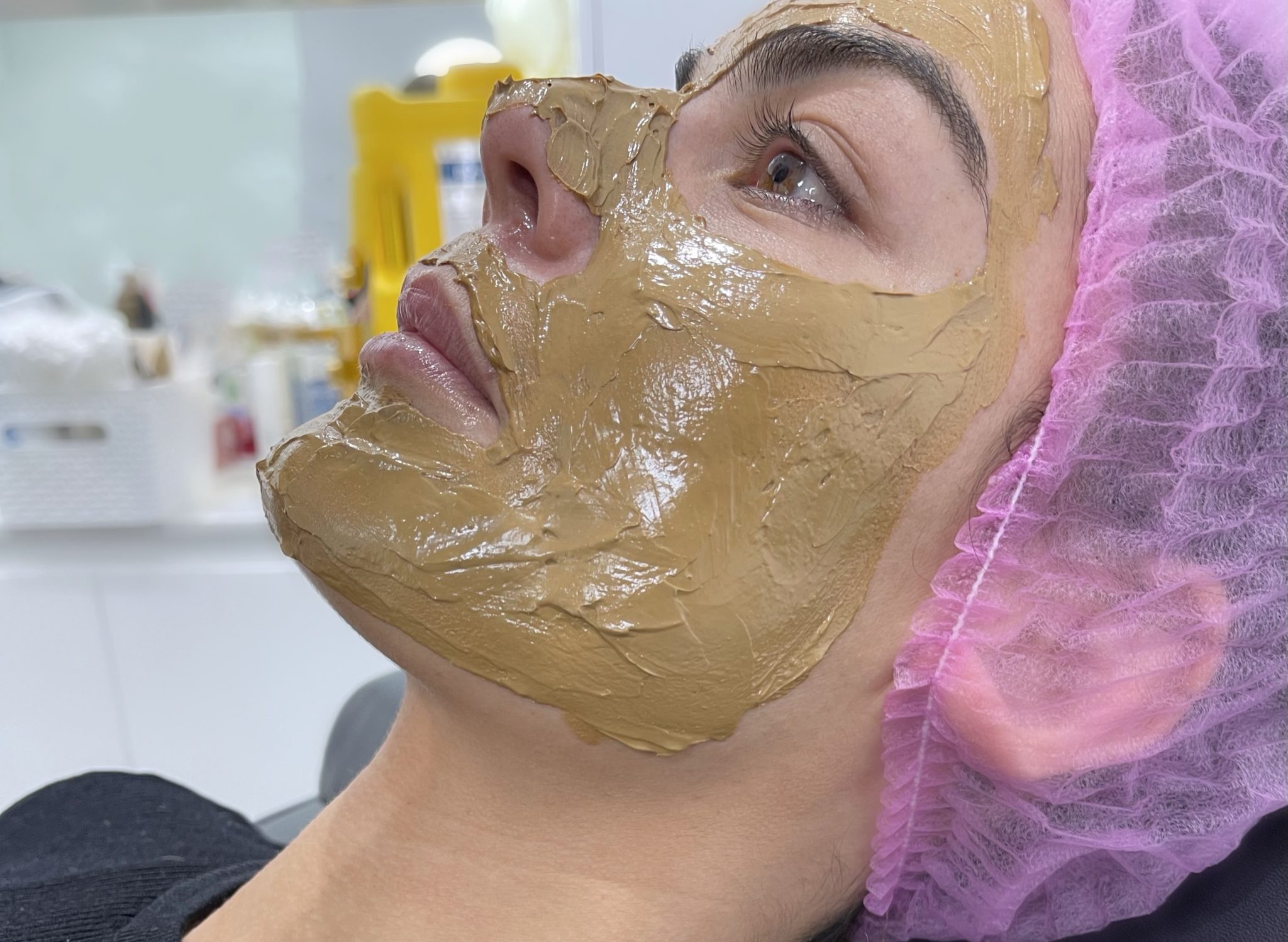 Reduce Hyperpigmentation with Cosmelan | The Cosmetic Lounge